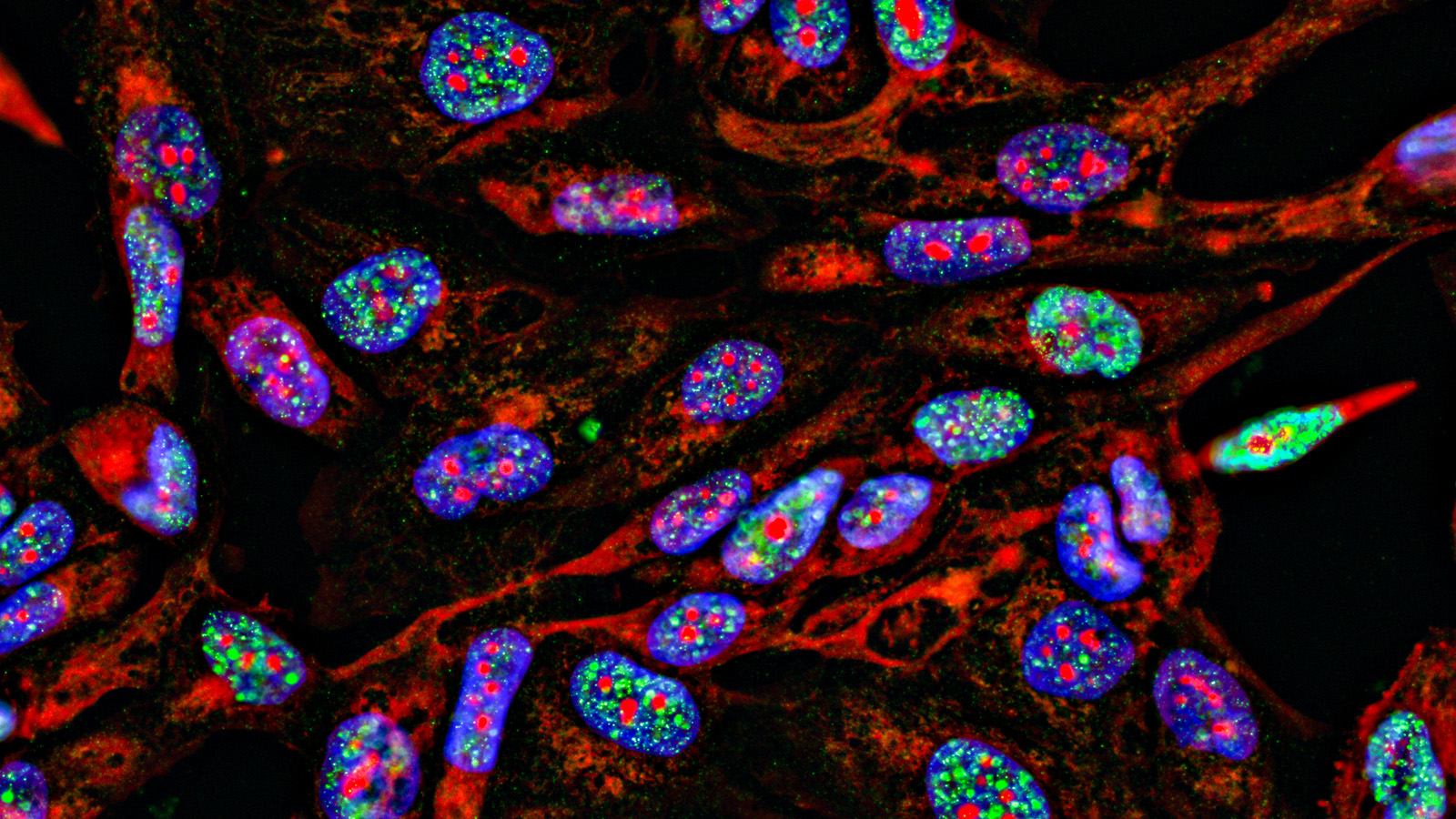 Advanced cancer diagnostics - The Health Policy Partnership
